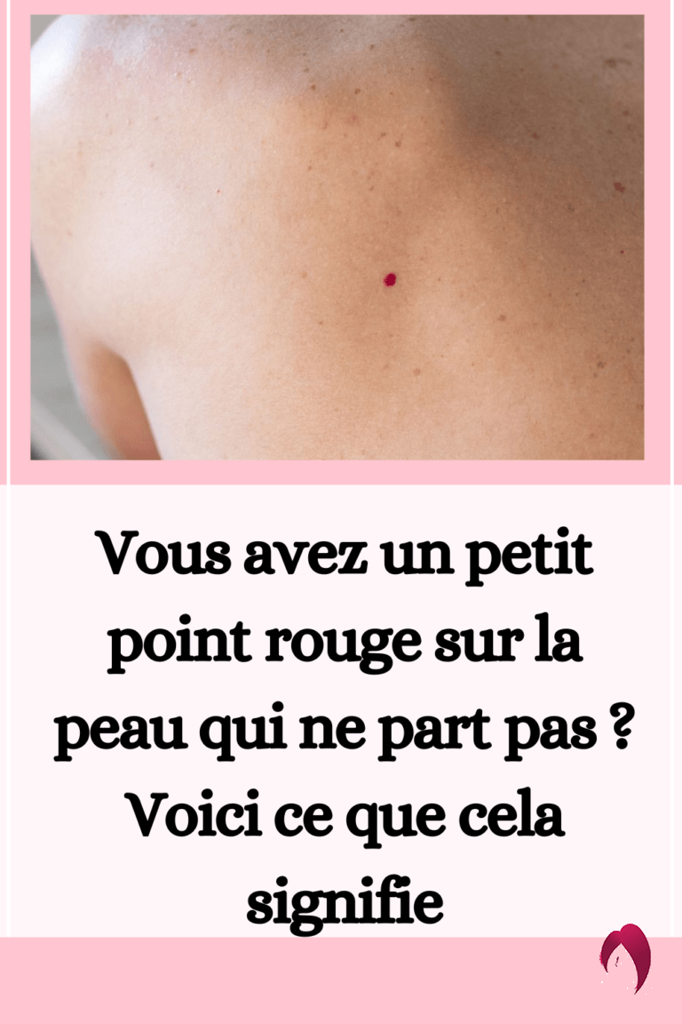 Vous avez un petit point rouge sur la peau qui ne part pas