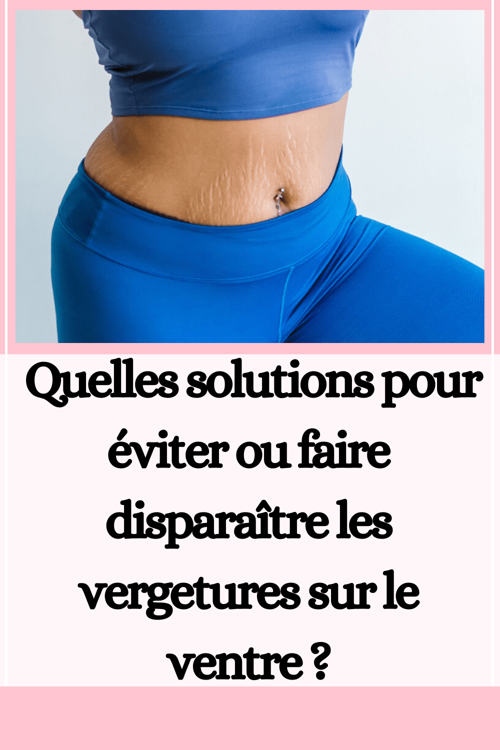 Comment se débarrasser des vergetures sur le ventre